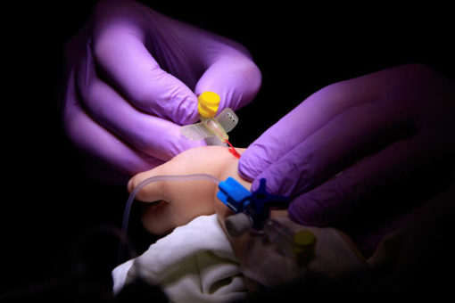 PICC Line Placement in the NICU - Daily Nurse
