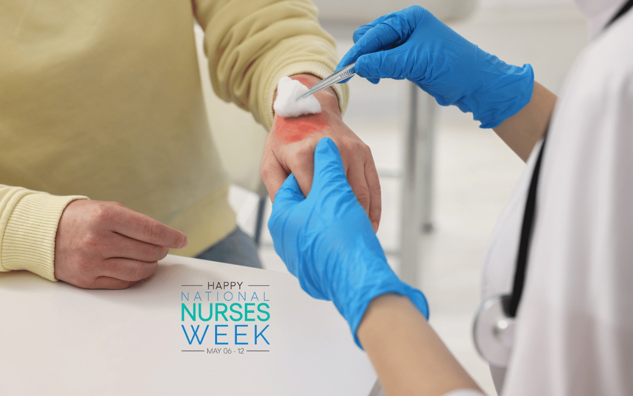 Burn Care for Underserved Communities - A Certified Burn Nurse s ...